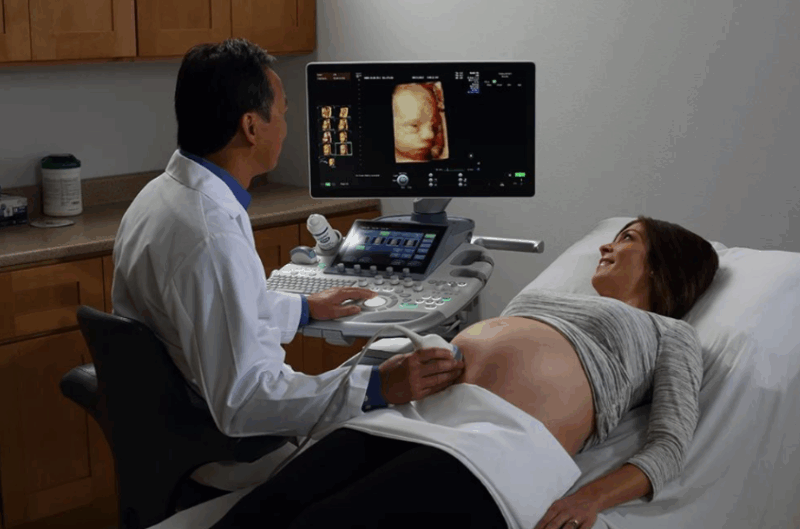 Must-Read Before Your Scan: Level 2 Ultrasound Purpose, Risks, Benefits ...
